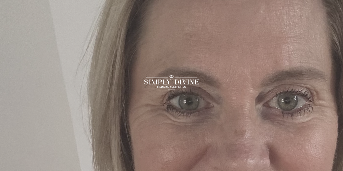 Simply Divine Medical Aesthetics Limited